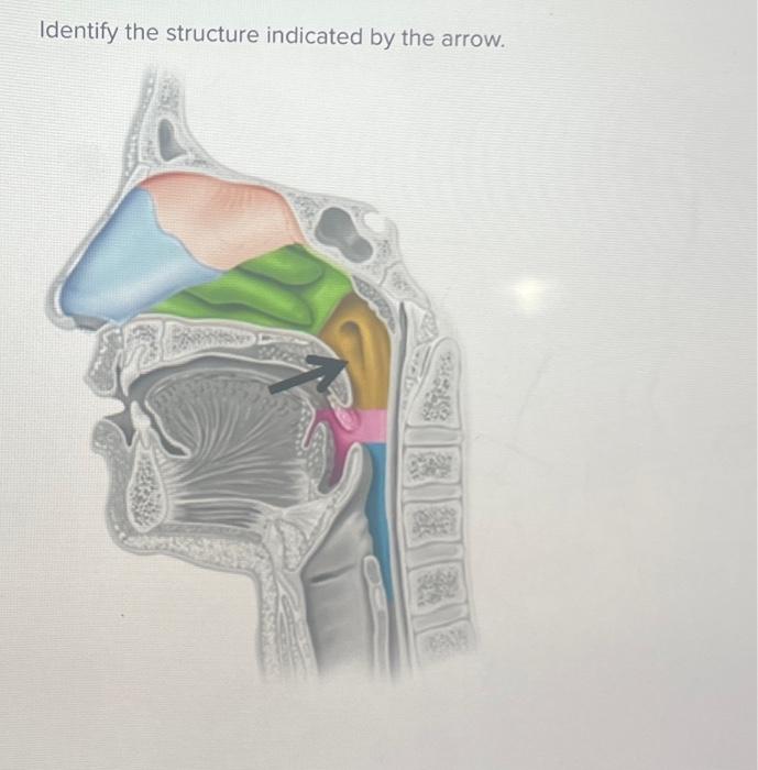 Solved Identify the structure indicated by the arrow. | Chegg.com