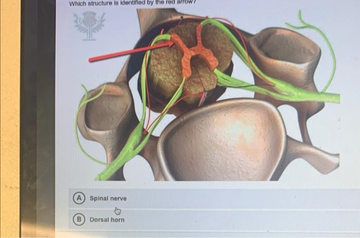 Solved Which structure is identified by the red arrow? | Chegg.com