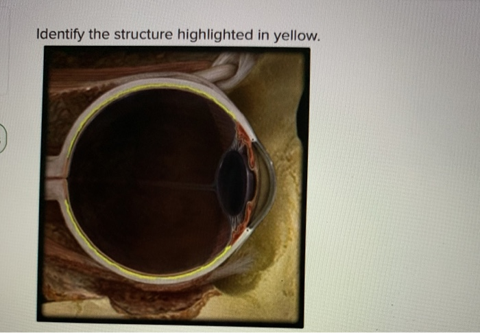Solved Identify the structure highlighted in yellow. Ο | Chegg.com
