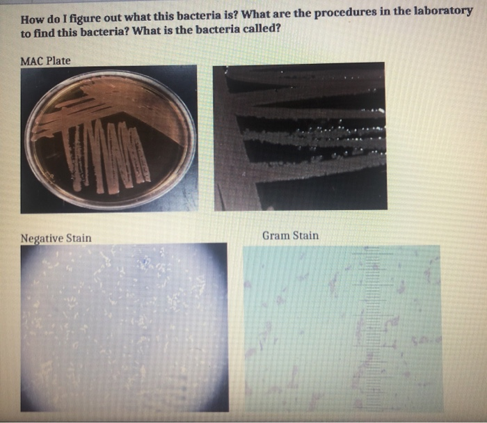 Solved How do I figure out what this bacteria is? What are | Chegg.com