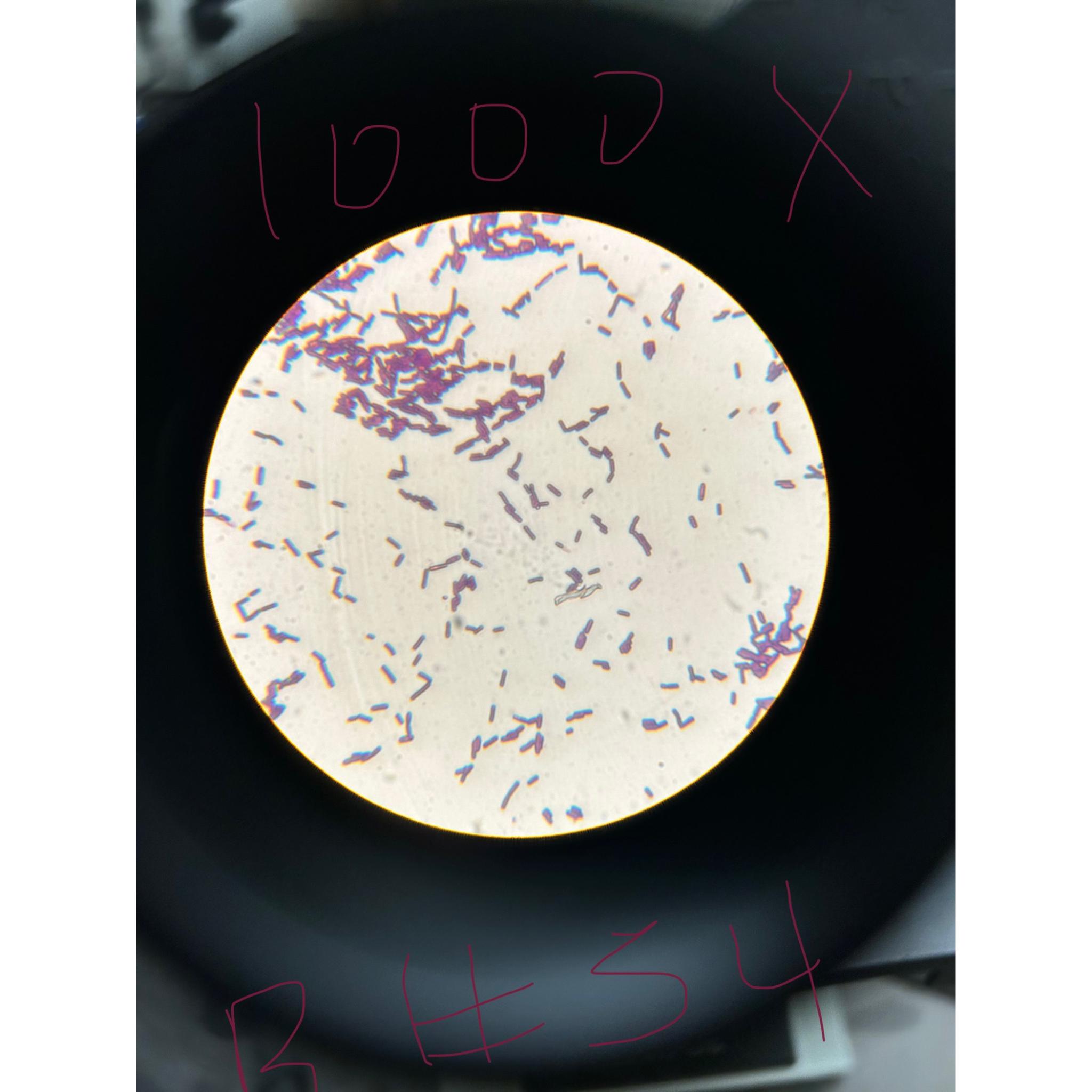 Solved Does this bacteria look Gram Stain Positive (Purple) | Chegg.com