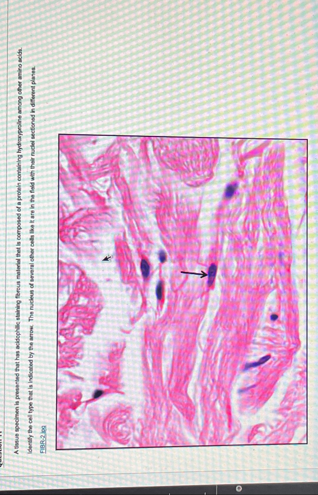 Solved A tissue specimen is presented thet has acidophilic | Chegg.com
