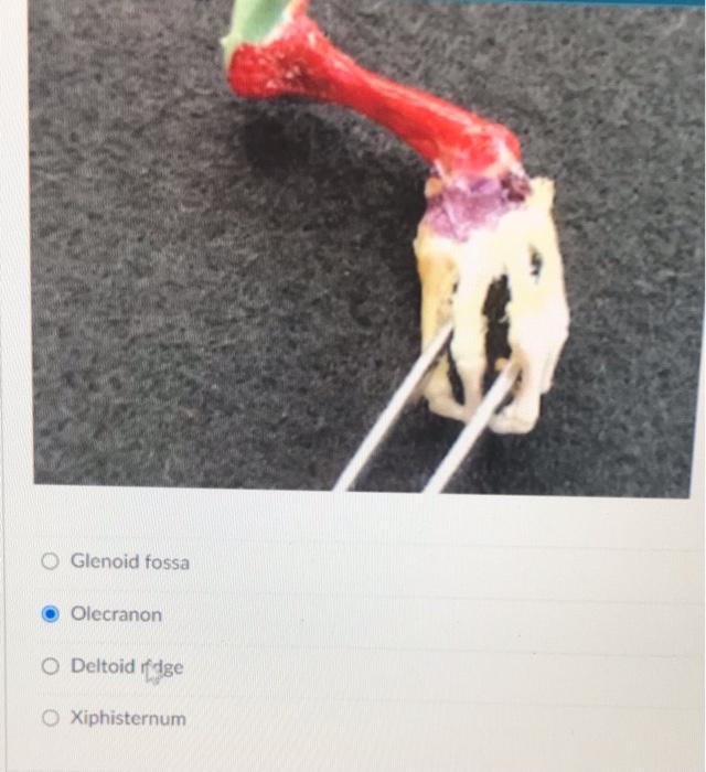 Solved The term for the extended process in the proximal end | Chegg.com