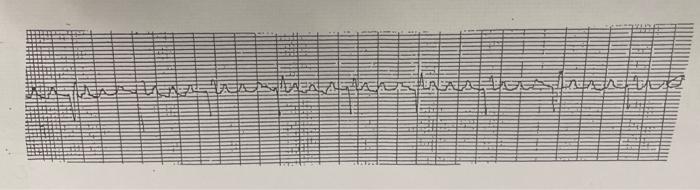 Solved What is the ventricular rate of the ECG strip | Chegg.com