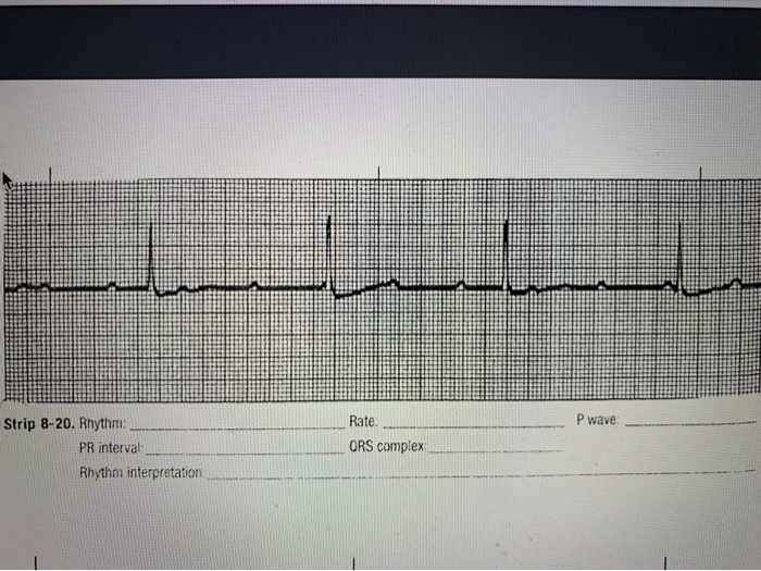 Solved P wave: - Strip 8-20. Rhythm: PR interval Rhythm | Chegg.com