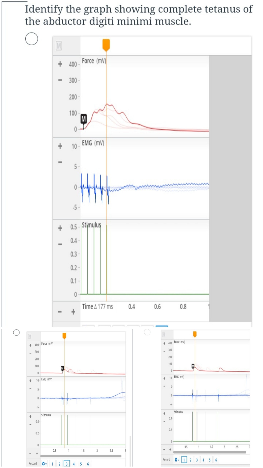 Solved Identify the graph showing complete tetanus of the | Chegg.com