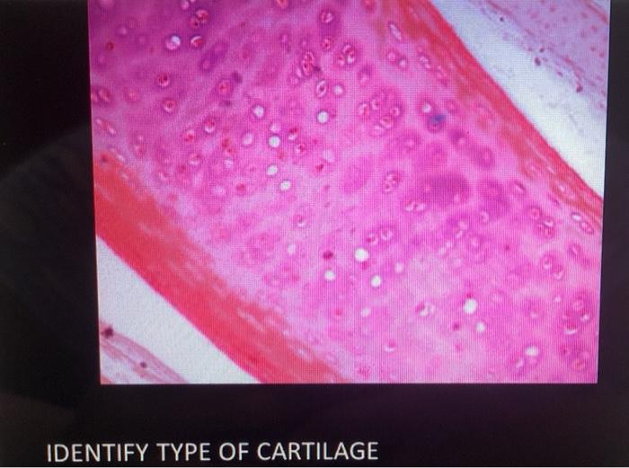 Solved IDENTIFY TYPE OF CARTILAGE | Chegg.com