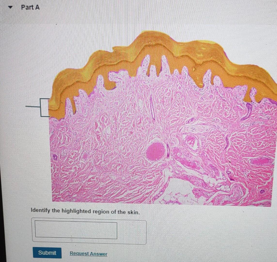 Solved Identify the highlighted region of the skin. | Chegg.com