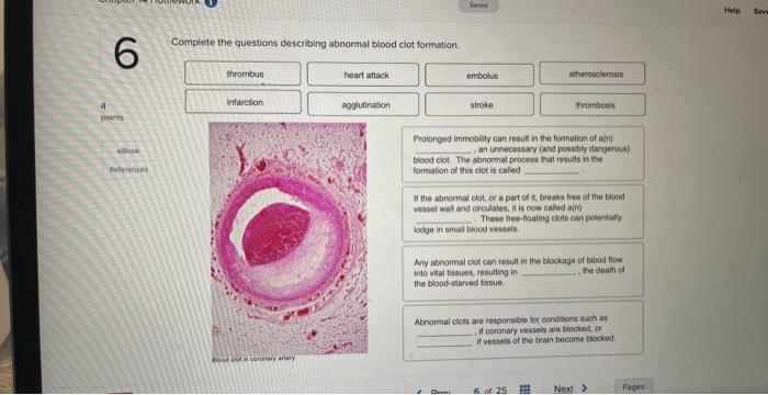 Solved Complete the questions describing abnormal blood clot | Chegg.com