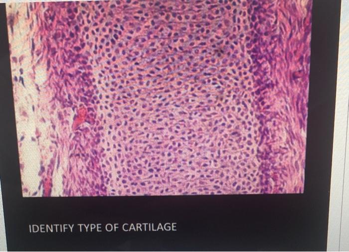 Solved IDENTIFY TYPE OF CARTILAGE WHAT ARE THEN CONNECTIVE | Chegg.com