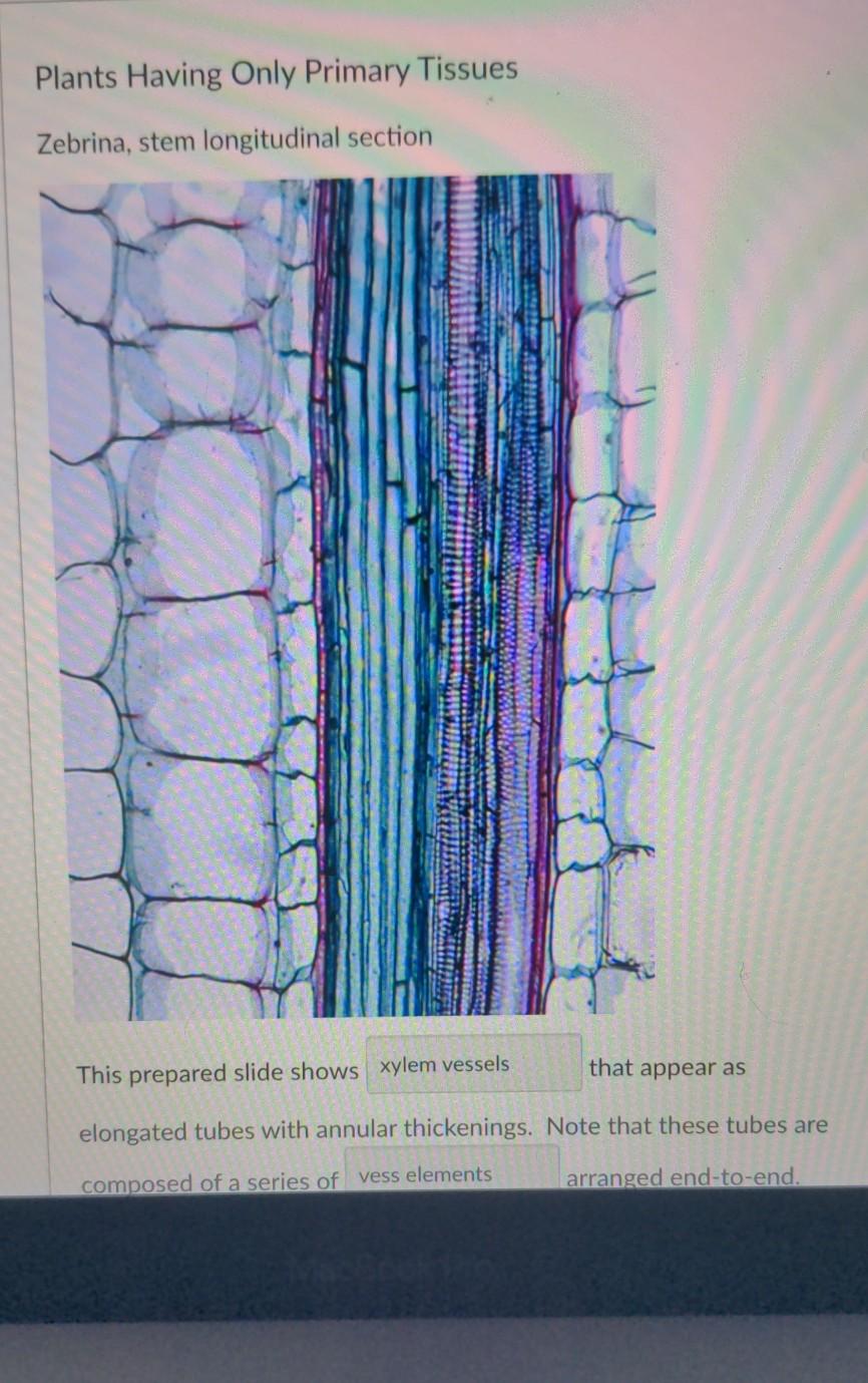 Solved Plants Having Only Primary Tissues Zebrina, stem | Chegg.com
