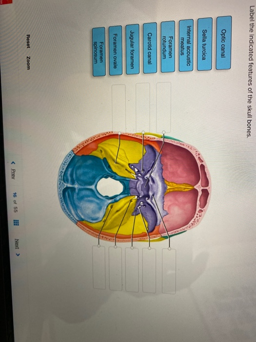 Solved Label the indicated features of the skull bones. | Chegg.com