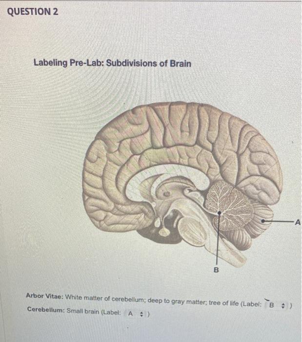 Solved QUESTION 1 Labeling Pre-Lab: Subdivisions of Brain А | Chegg.com
