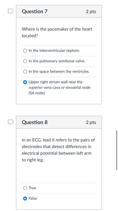 Solved Where is the pacemaker of the heart located? In the | Chegg.com