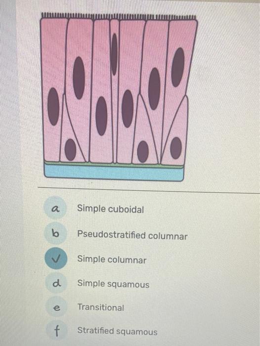Solved а a Simple cuboidal bo Pseudostratified columnar | Chegg.com