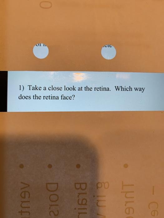 Solved 0 LIO cil 1) Take a close look at the retina. Which | Chegg.com