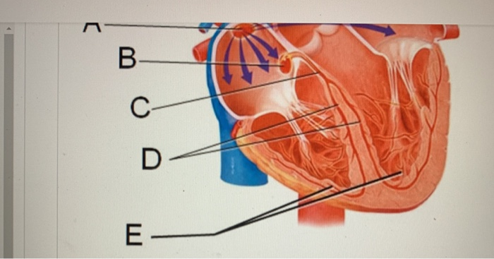 Solved Which labeled structure in the figure is the AV node? | Chegg.com