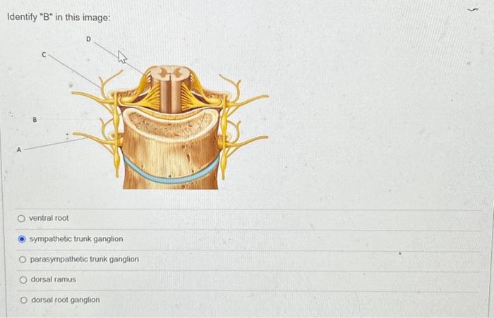 Sympathetic Trunk Ganglion