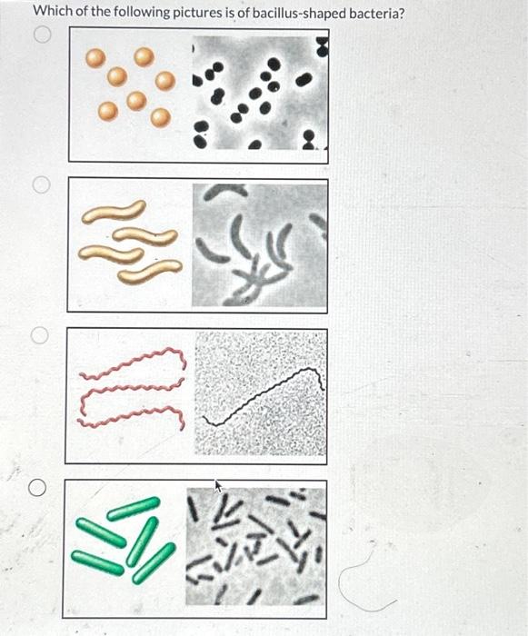 Solved Which of the following pictures is of bacillus-shaped | Chegg.com