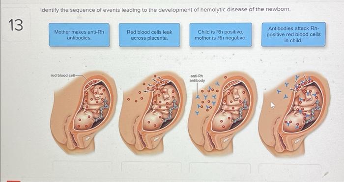 Solved Identify the sequence of events leading to the | Chegg.com