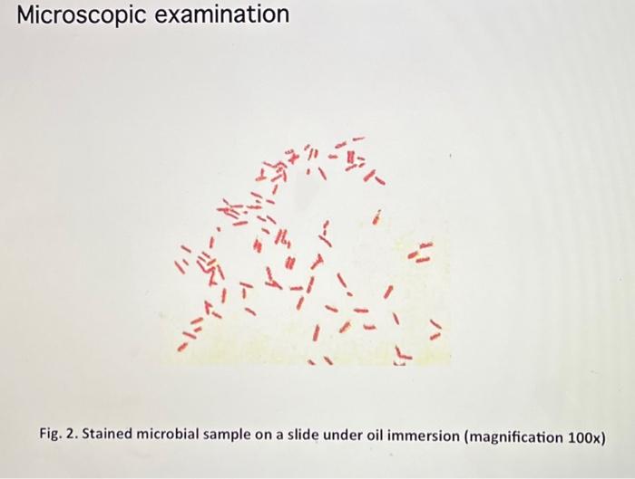Solved Macroscopic examination Microscopic examination | Chegg.com