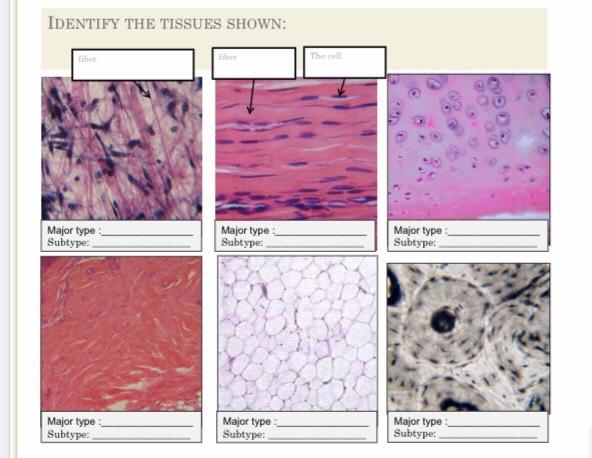 Solved IDENTIFY THE TISSUES SHOWN: ther The Major type: | Chegg.com