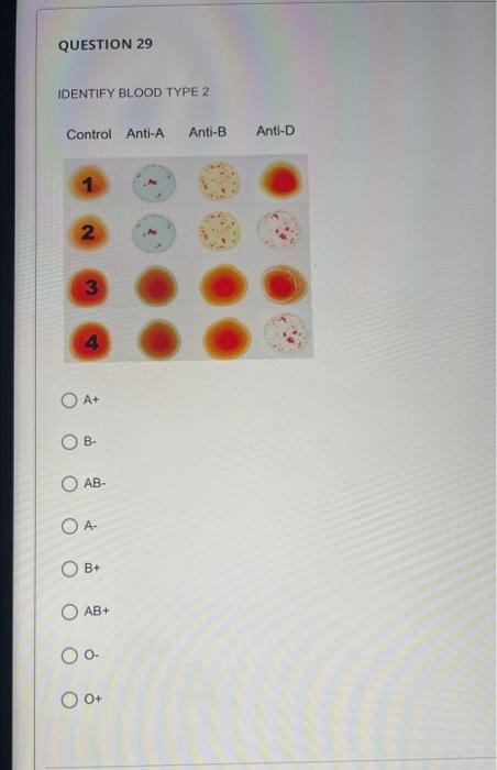 Solved QUESTION 29 IDENTIFY BLOOD TYPE 2 Control Anti-A | Chegg.com