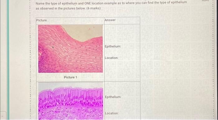 Solved Name the type of epithelium and ONE location example | Chegg.com