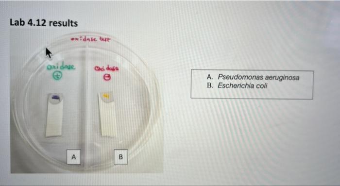 Solved Lab 4.12 results oxidase test Oxidase Od dose e A. | Chegg.com