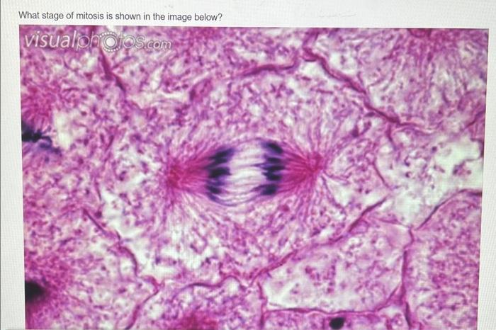 Solved What stage of mitosis is shown in the image below? | Chegg.com