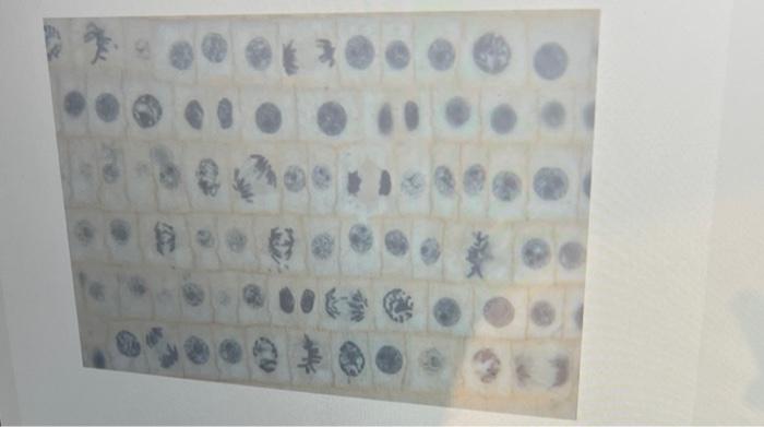 Solved what is the total number of interphase cells in this | Chegg.com