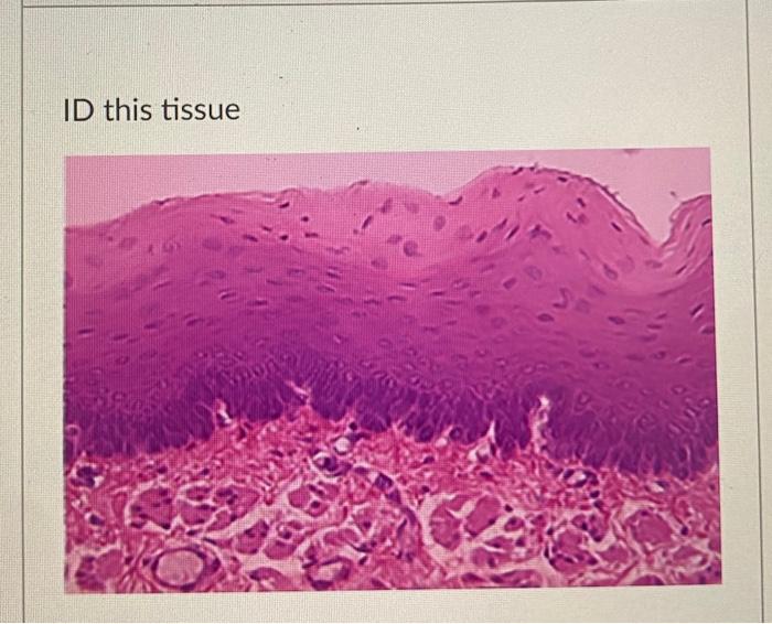Solved ID this tissue | Chegg.com