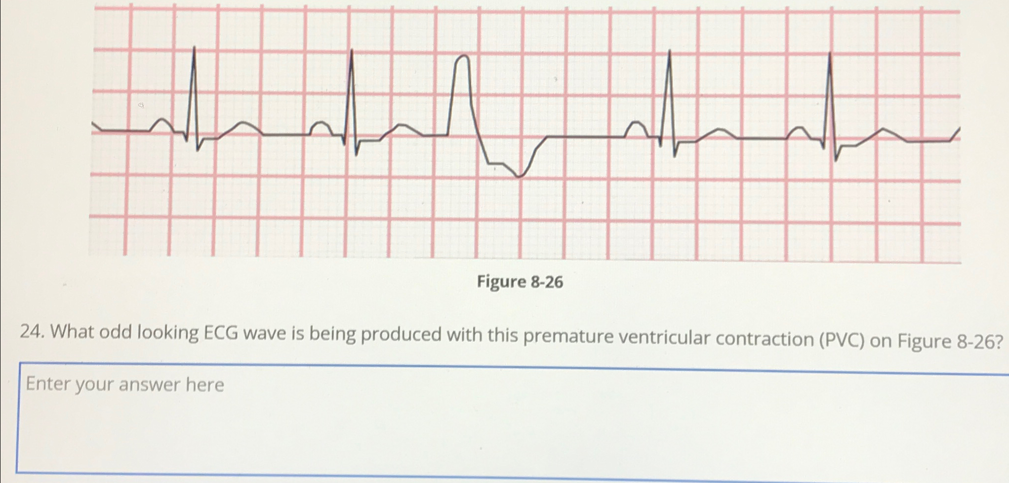 Solved Figure 8-2624. ﻿What odd looking ECG wave is being | Chegg.com
