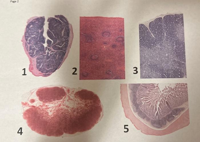 Solved Lymphatic Organs and Tissues - Cortex - Hilum - | Chegg.com
