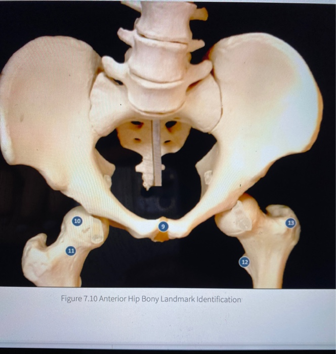 Solved Figure 7.10 Anterior Hip Bony Landmark Identification | Chegg.com