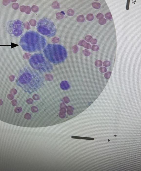 Solved identifybthe cells from a peritoneal fluid | Chegg.com