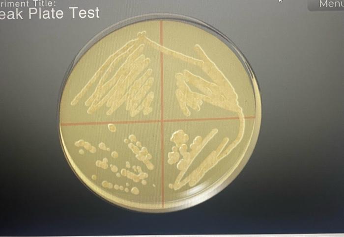 Solved 2) You are a clinical microbiologist and receive a | Chegg.com