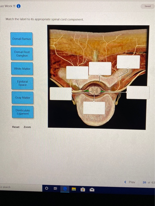 Solved uiz Week 11 6 Savod Match the label to its | Chegg.com
