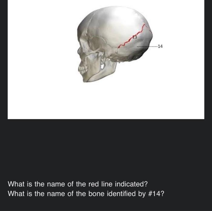 Solved -14 What is the name of the red line indicated? What | Chegg.com