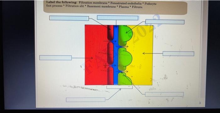 Label the following: Filtration metrbrane * | Chegg.com
