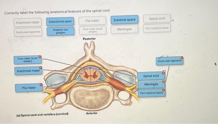 Solved Correctly label the following anatomical features of | Chegg.com