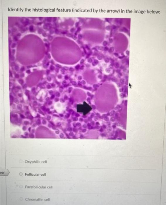 Solved Identify the histological feature (indicated by the | Chegg.com