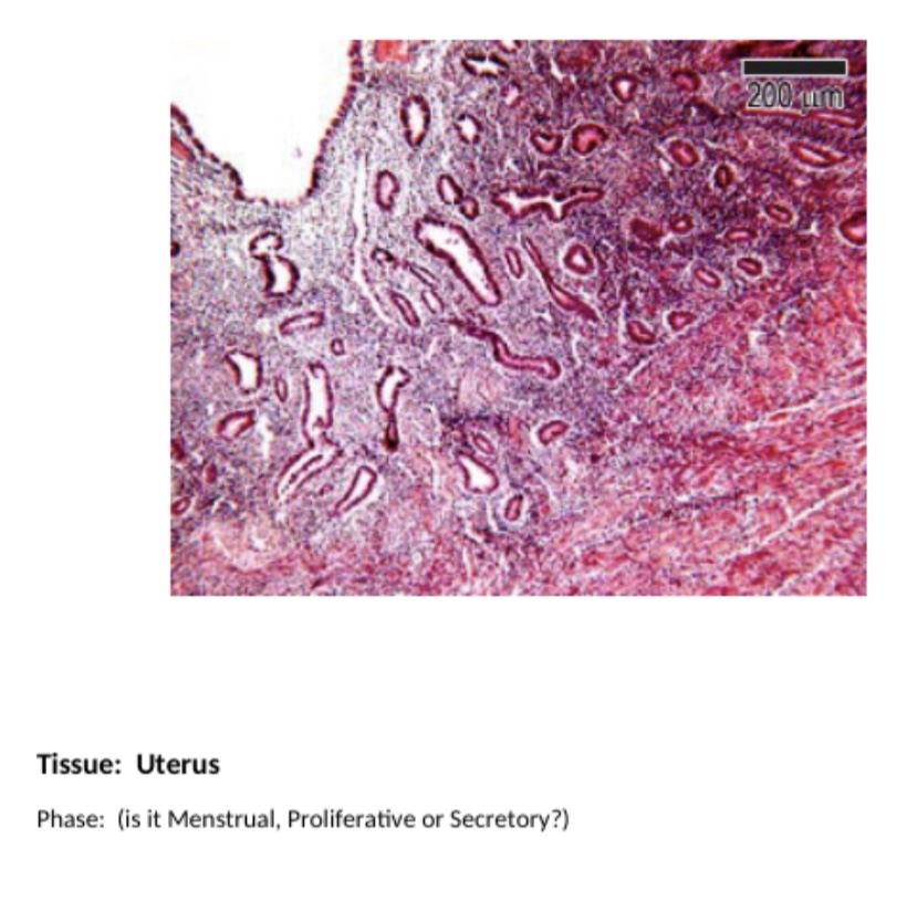 Solved Tissue: UterusPhase: (is it Menstrual, Proliferative | Chegg.com