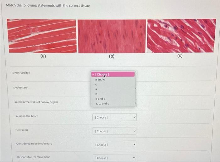Solved Match the following statements with the correct | Chegg.com