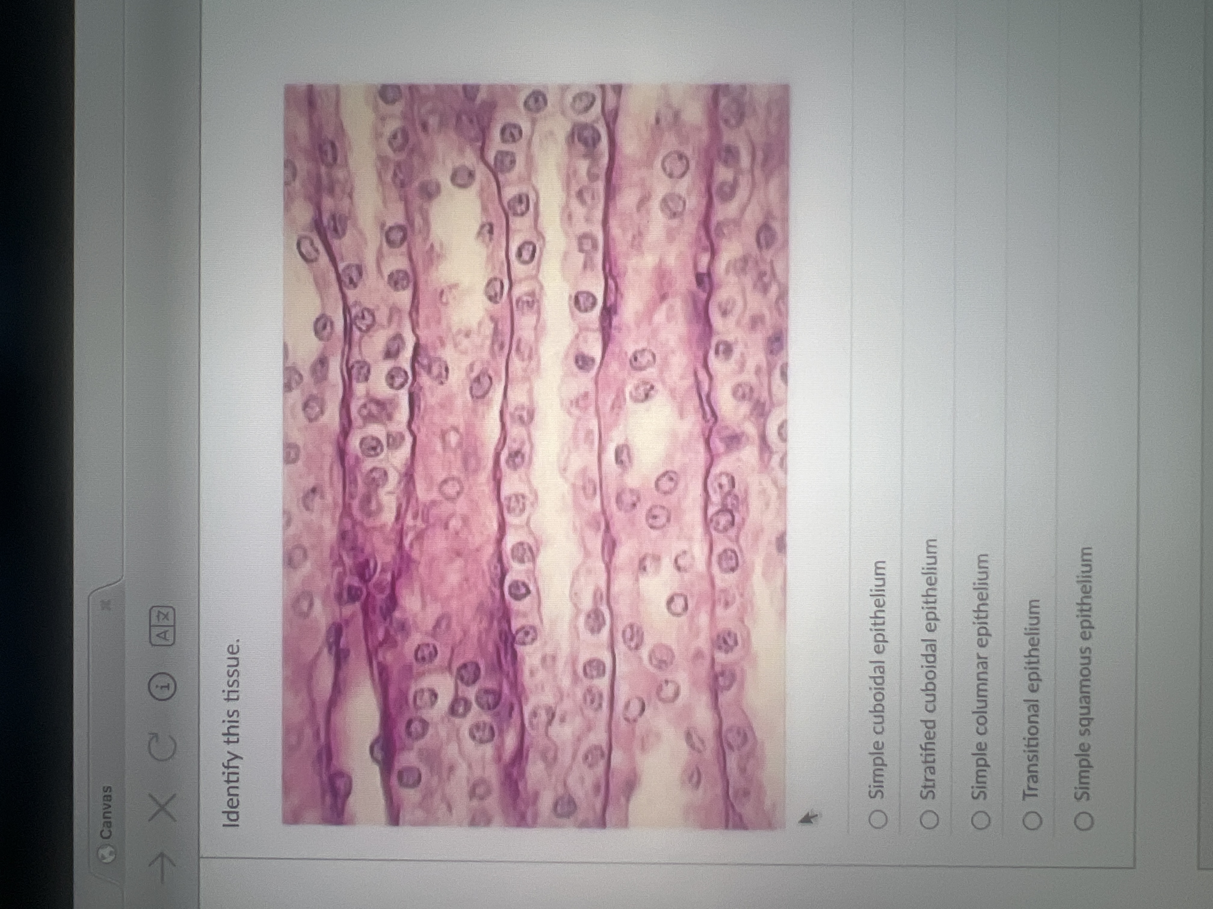 Solved Identify this tissue.Simple cuboidal | Chegg.com