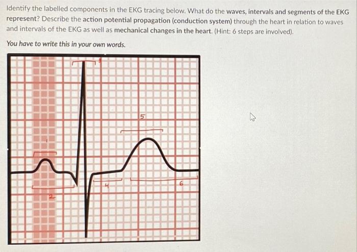 Solved Identify the labelled components in the EKG tracing | Chegg.com