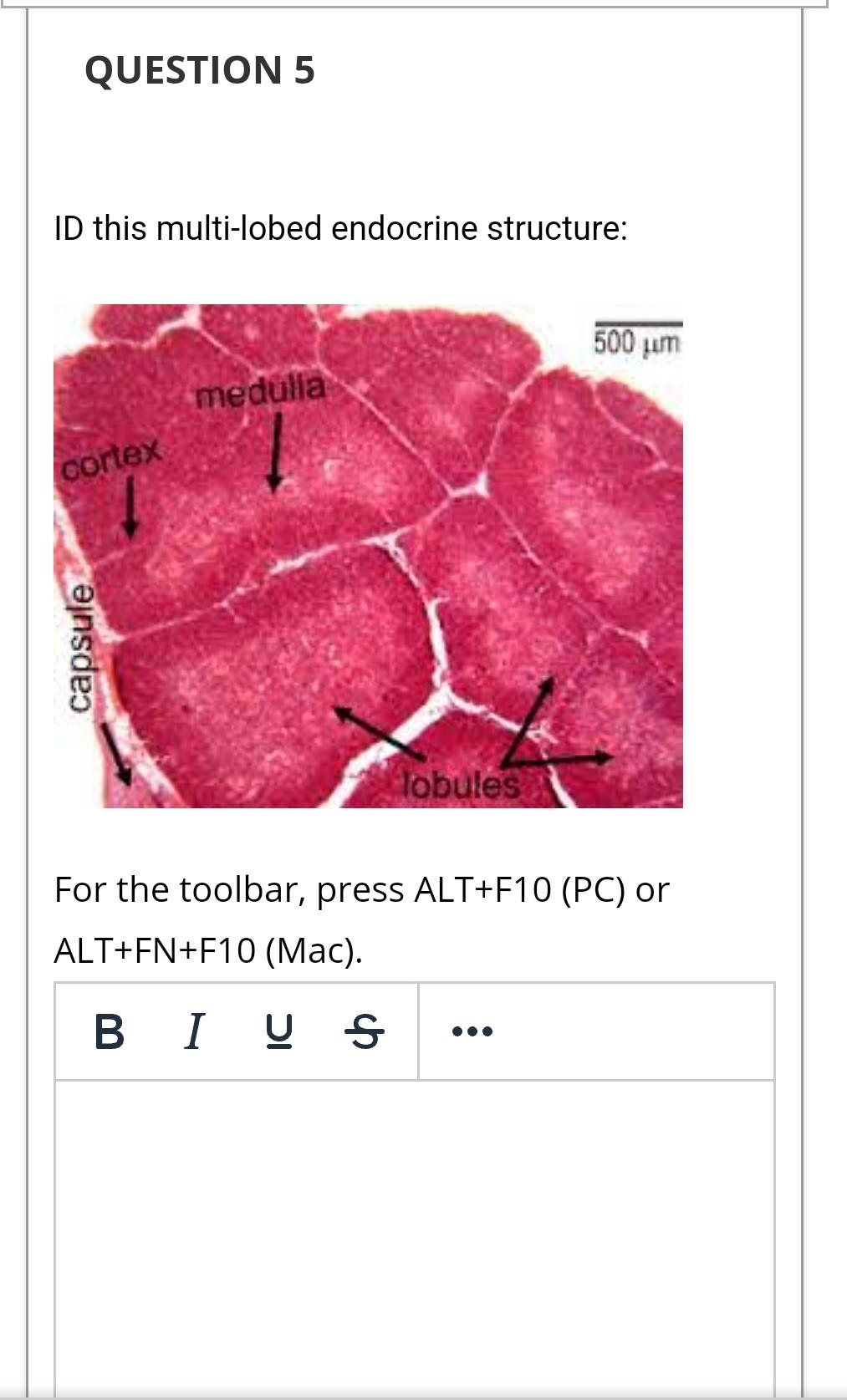 Solved QUESTION 5 ID this multi-lobed endocrine structure: | Chegg.com