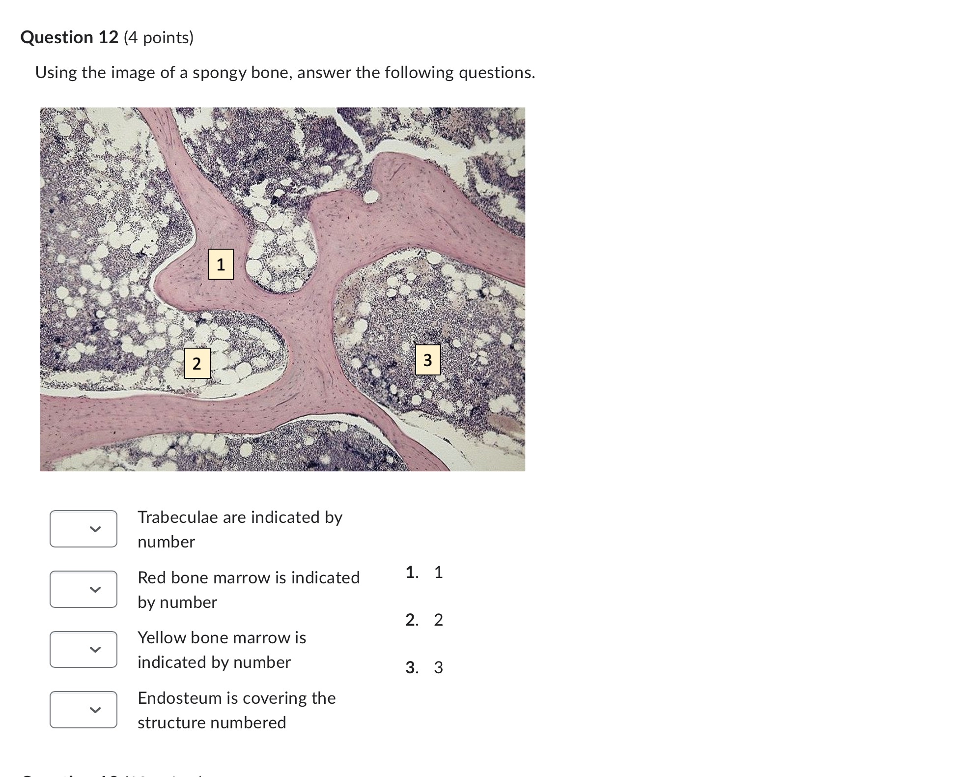 Solved Question 12 (4 ﻿points)Using the image of a spongy | Chegg.com