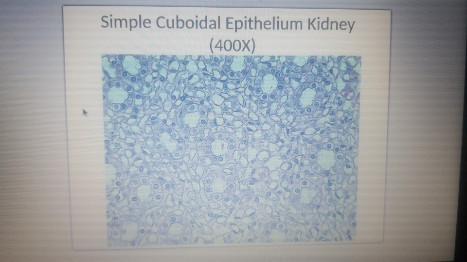 Solved Simple Cuboidal Epithelium Kidney (400x) | Chegg.com