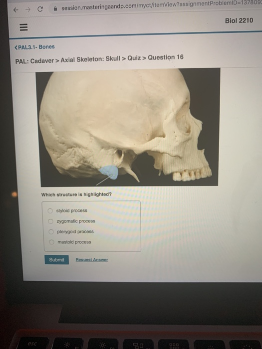 Solved: Biol Appendicular Skeleton: Joints > Quiz > Questi... | Chegg.com